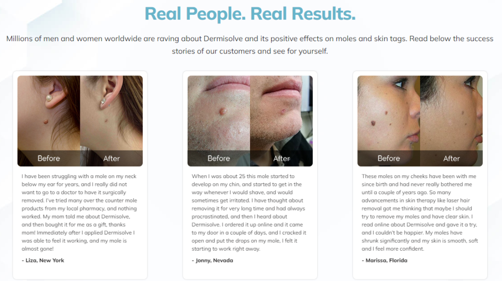 Say Goodbye to Skin Tags with Dermisolve Skin Tag Remover! - lookintofacts